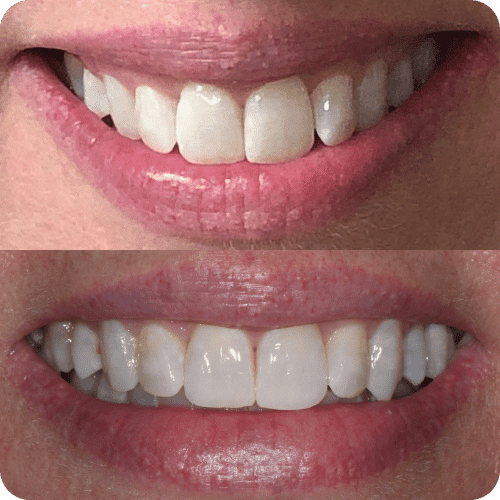 Functional Orthodontics: Optimal Jaw Development